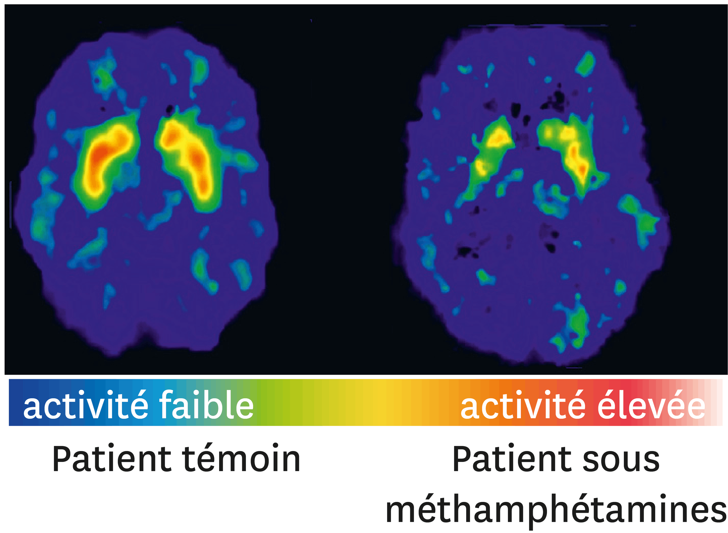 Quels sont les effets de nos comportements sur le système nerveux ? | Lelivrescolaire.fr