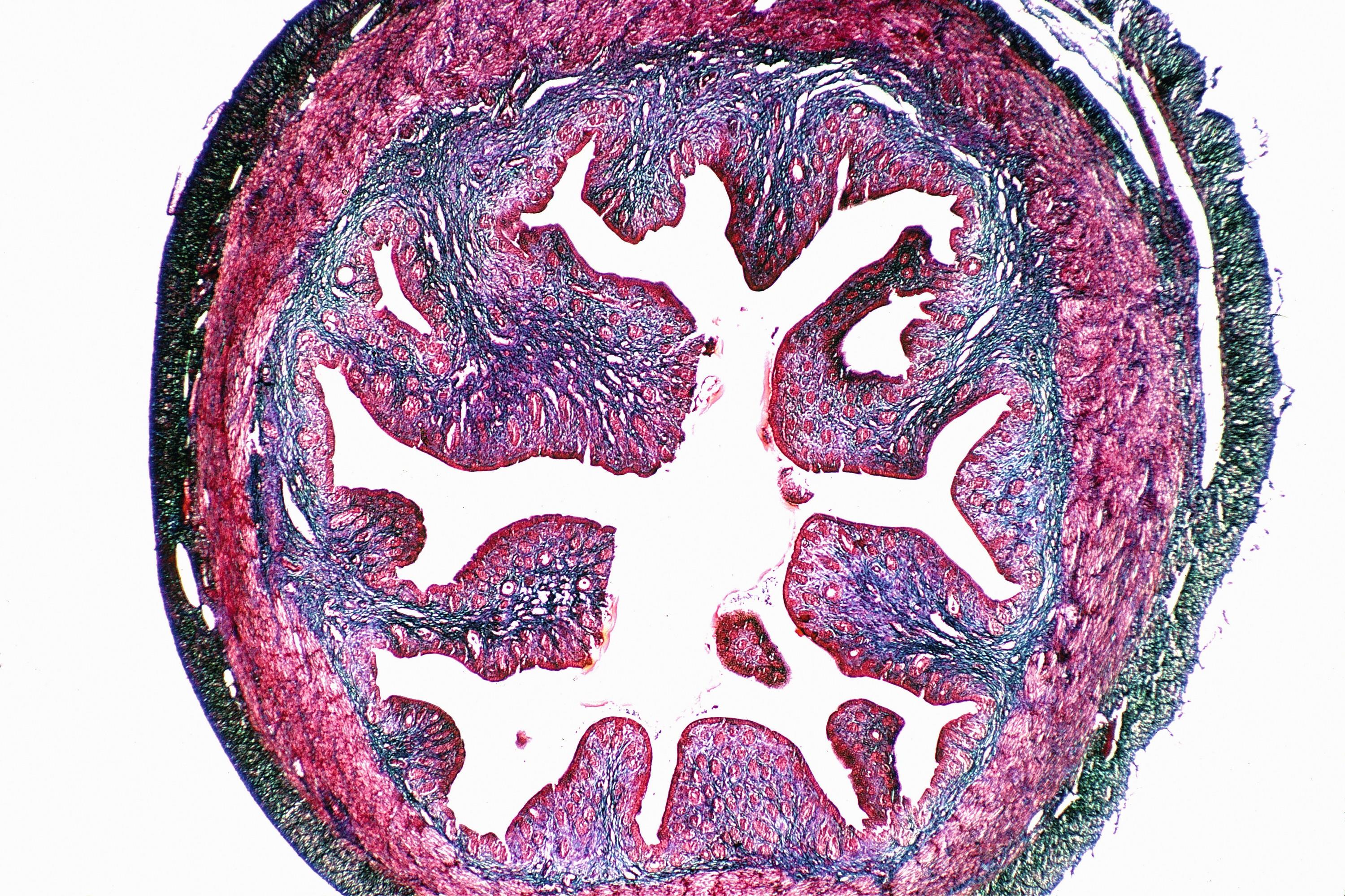 Maîtrise de la reproduction : Contraception, contragestion et IVG